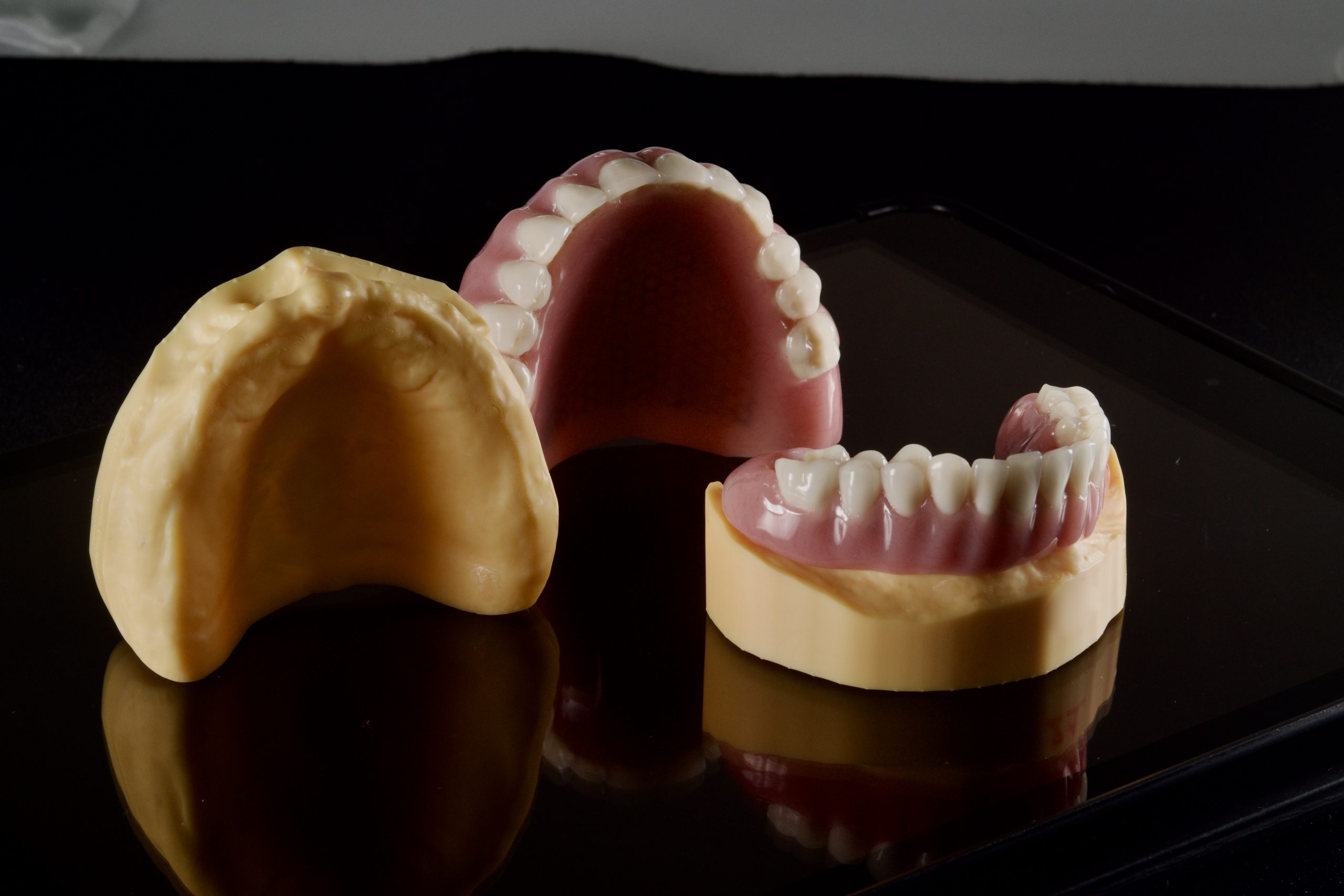 Digital workflow for an all-on-4, screw-retained, implant denture