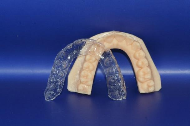 How Digital Technology Can Help with Post-Orthodontic Treatment