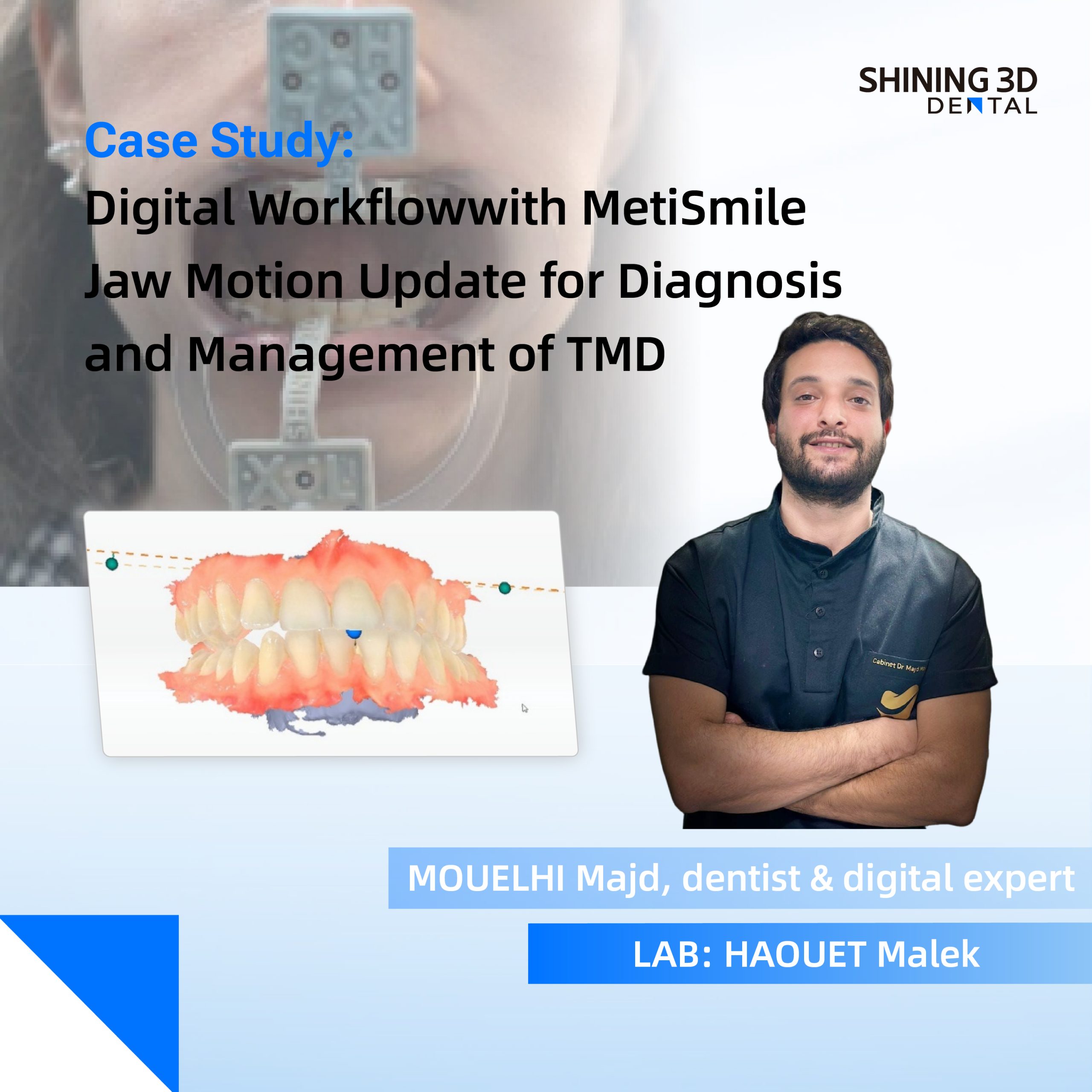 Digital Workflow with METISMILE Jaw motion update for Diagnosis and ...