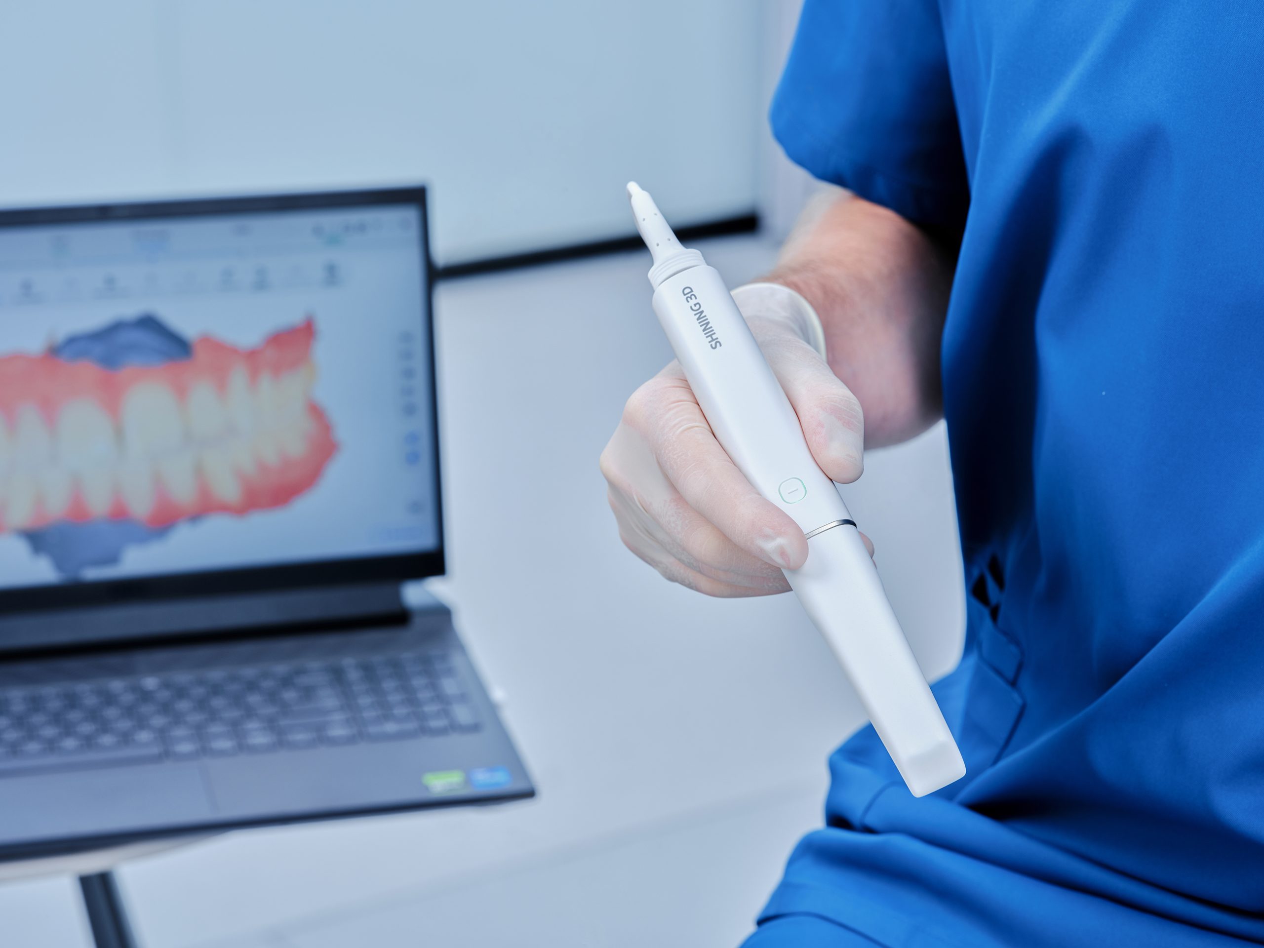 Aoralscan Elf by SHINING 3D Dental: A New Era of Smart Intraoral ...